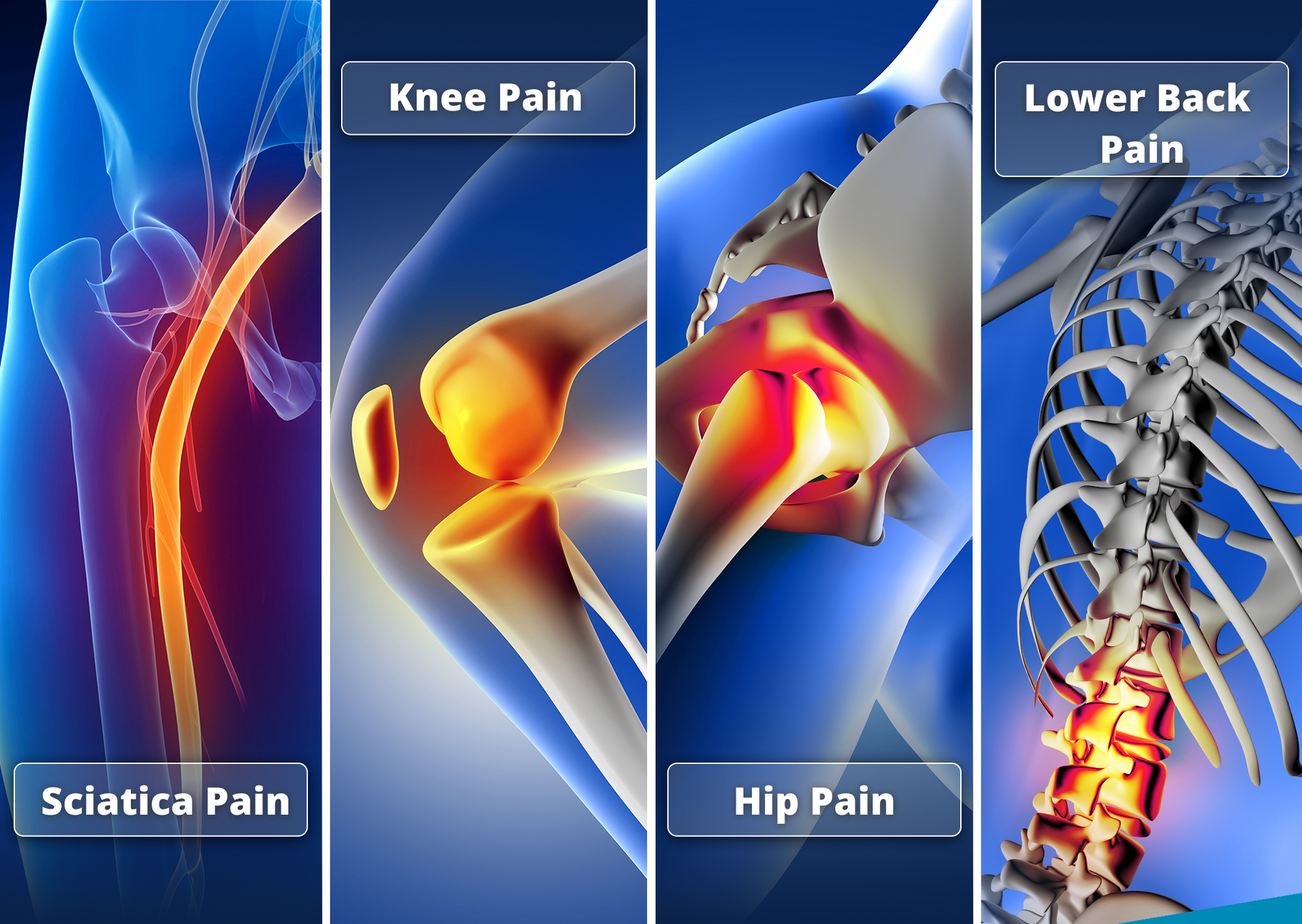 SmoothSpine™️ Alignment Pillow - Relieves Hip & Back Pain for Side Sle